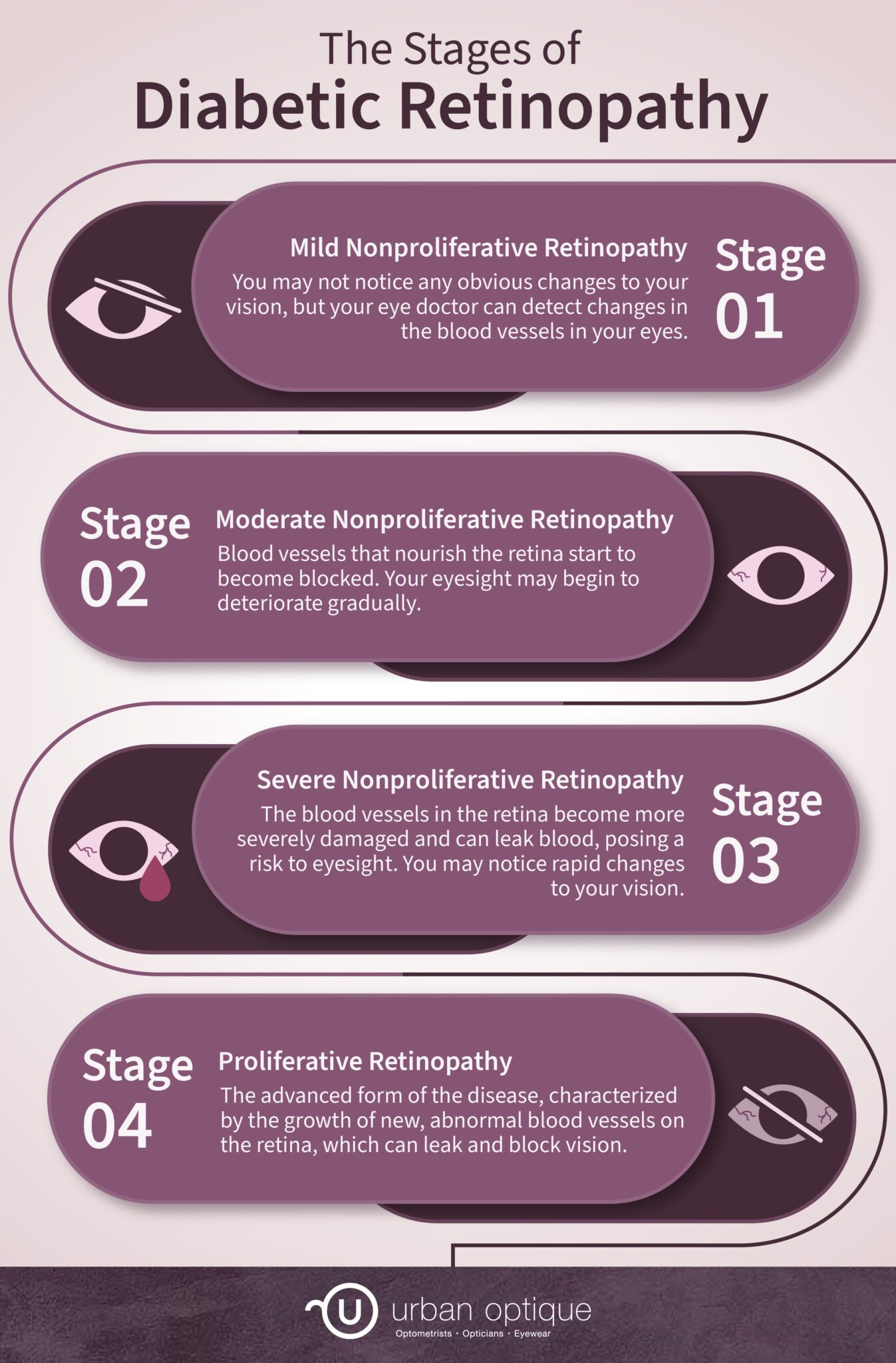 The 4 Stages of Diabetic Retinopathy | Urban Optique